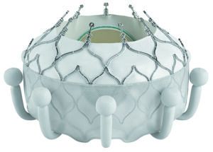 A Breakthrough Treatment for Tricuspid Valve Disease - Heart Advisor